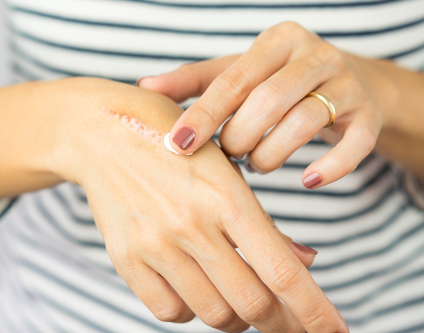 9 Hyaluronic Acid Benefits for Skin - Revive Clinic