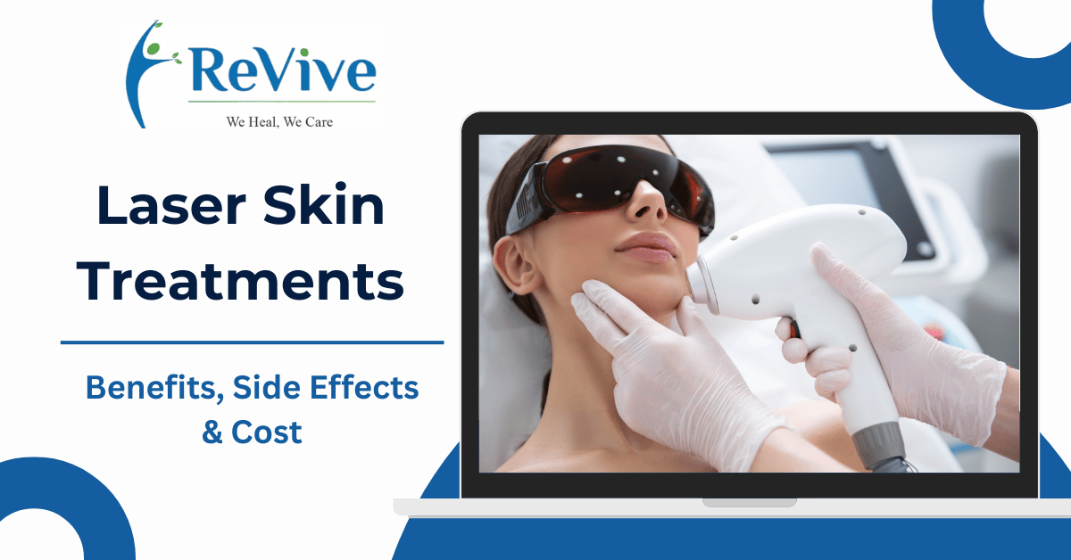 Laser Skin Treatments In India: Benefits, Side Effects & Cost - Revive ...